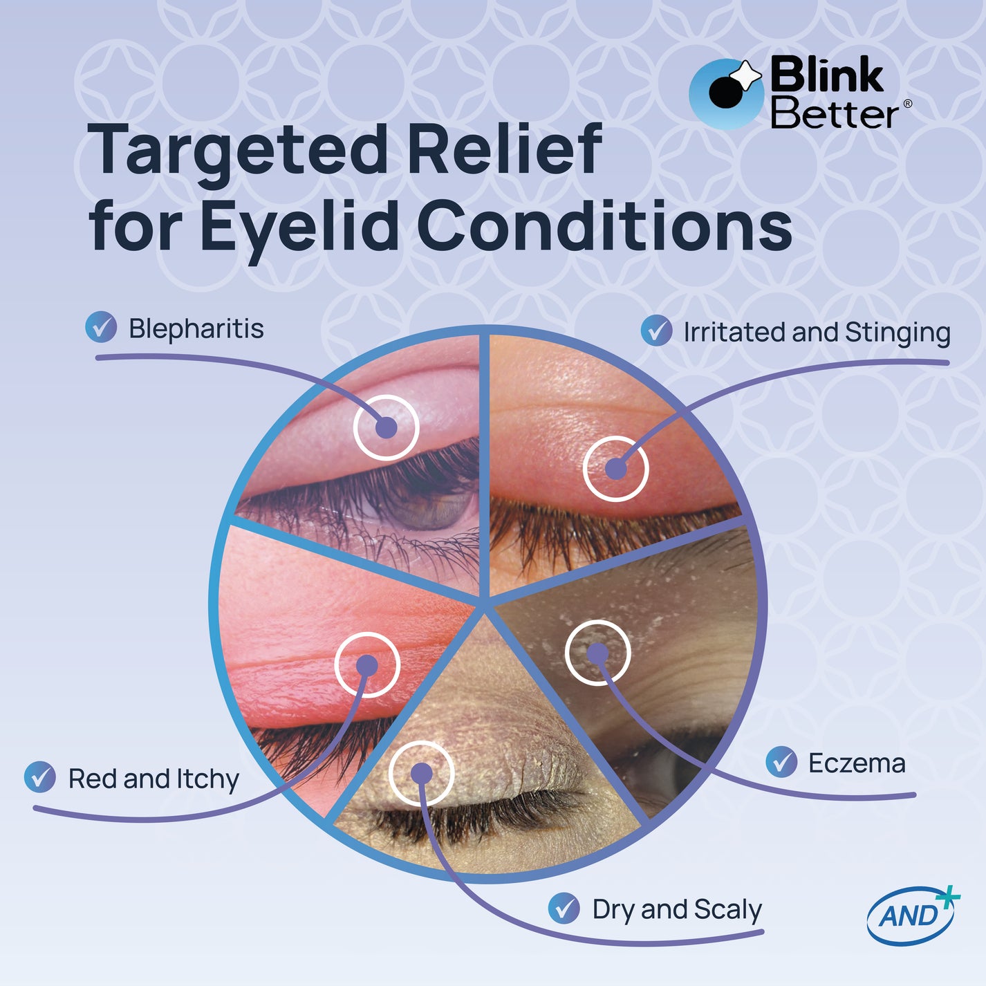 BetterLids Eyelid Ointment for Dry & Flaky Eyelids – BlinkBetter